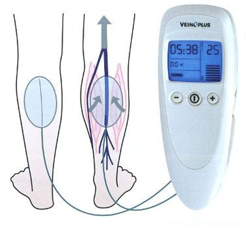 Veinoplus - Stymulator leczący zaburzenia żylne kończyn dolnych: ulotka ...